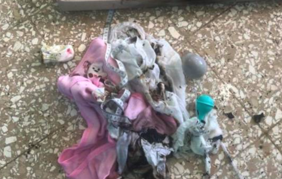 Explosión de bombillo ocasiona quemaduras una niña recién nacida en ...